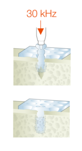 Resorb Pin and Plate System - VetWelding AG